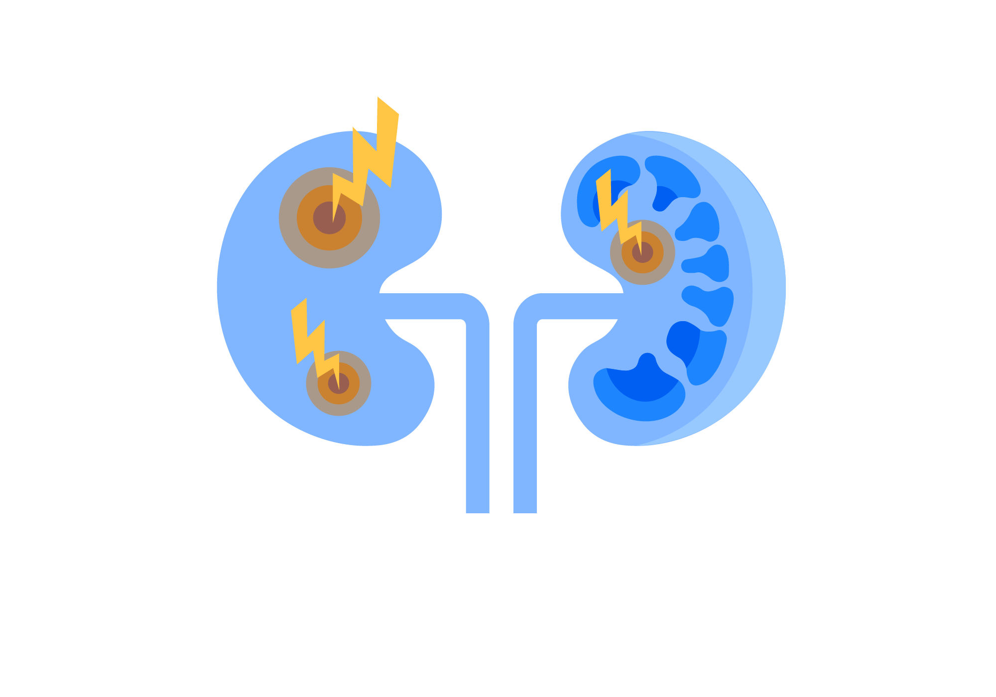 Nefritis intersticial | 3 Causas, Síntomas y Diagnóstico | Buoy