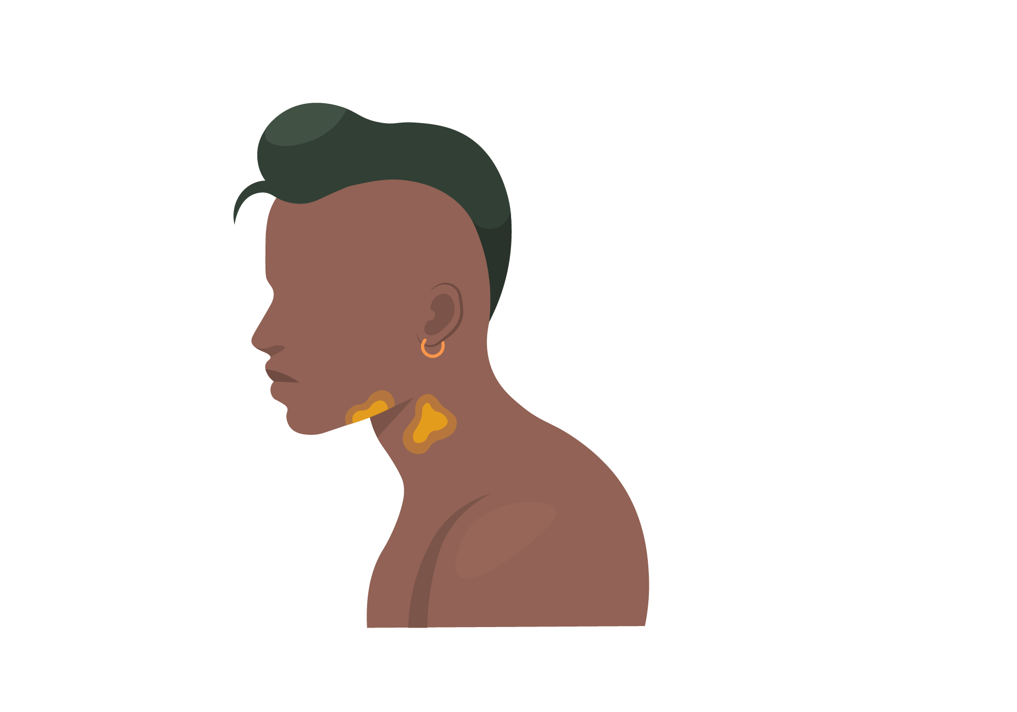 Linfangitis Síntomas, Causas y Opciones de Tratamiento | Buoy