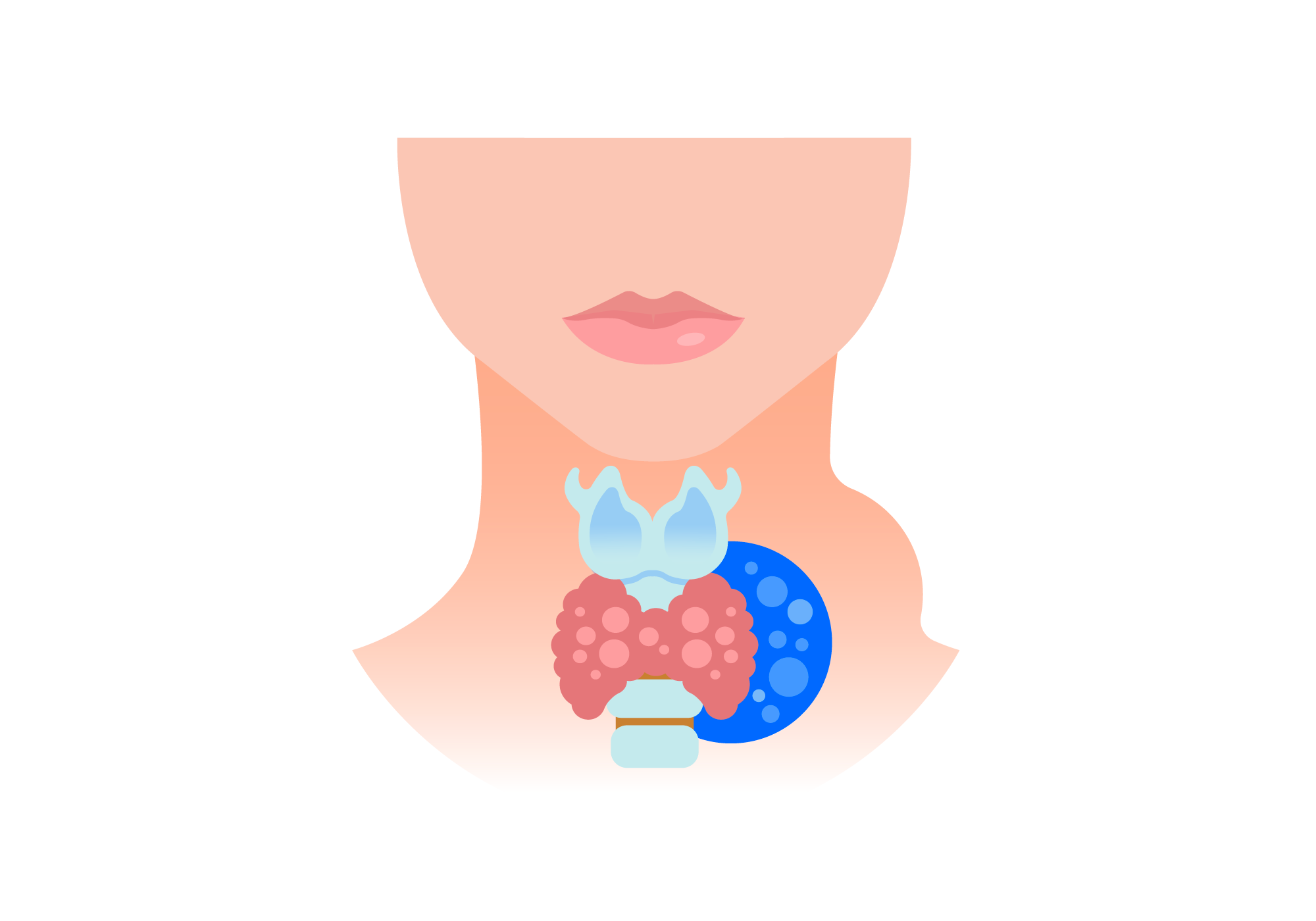 Hyperthyreose | Anzeichen einer Überfunktion der Schilddrüse und warum ...