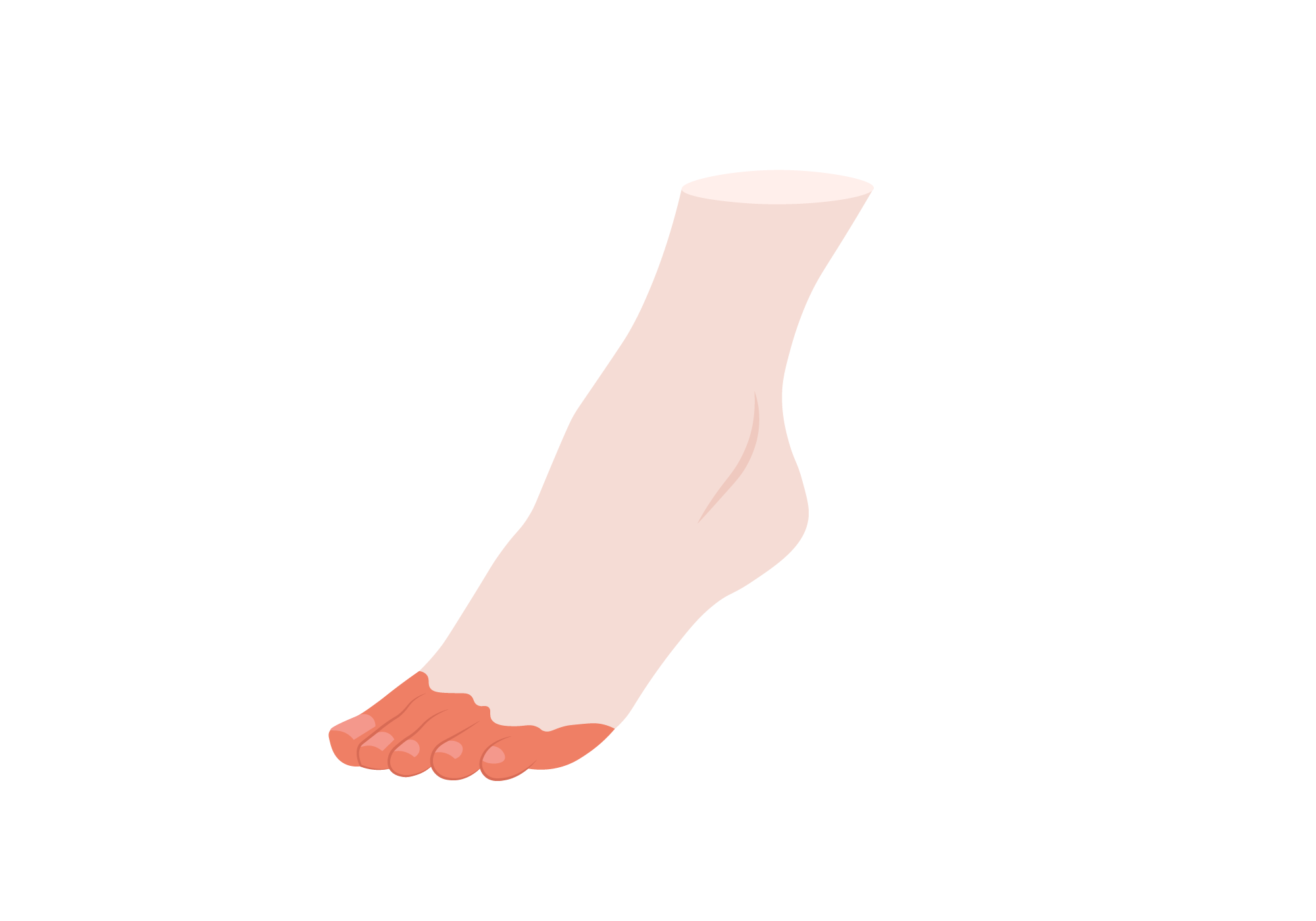 Red Toes | What Causes Toe Redness & How to Treat