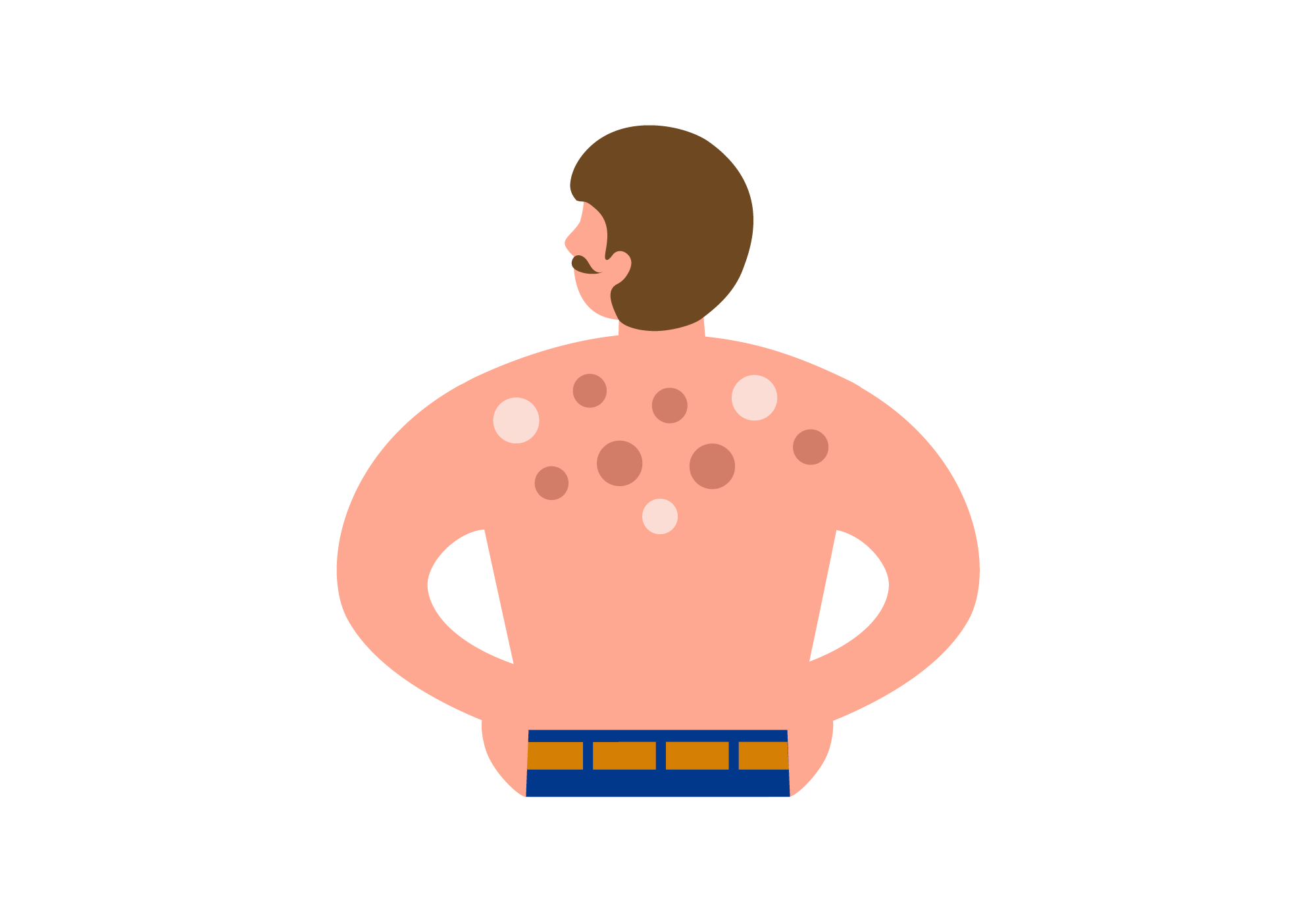 9 Causes for Bumps on Back | What You Need to Know | Buoy